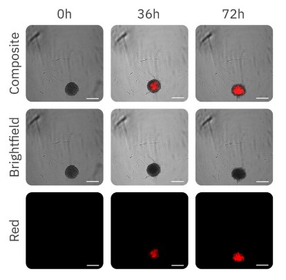 Quantifying chemotoxicity on cancer cell colony formation using live ...