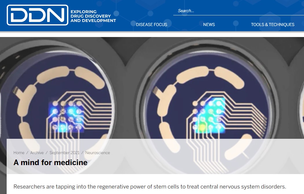 Neural Organoid Insights | Axion Biosystems