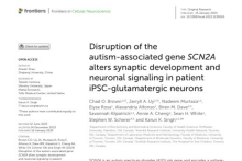 Disruption of the autism-associated gene SCN2A alters synaptic ...