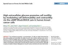 High extracellular glucose promotes cell motility by modulating cell ...