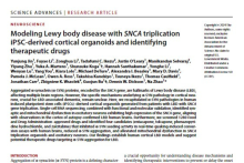Modeling Lewy body disease with SNCA triplication iPSC-derived cortical ...